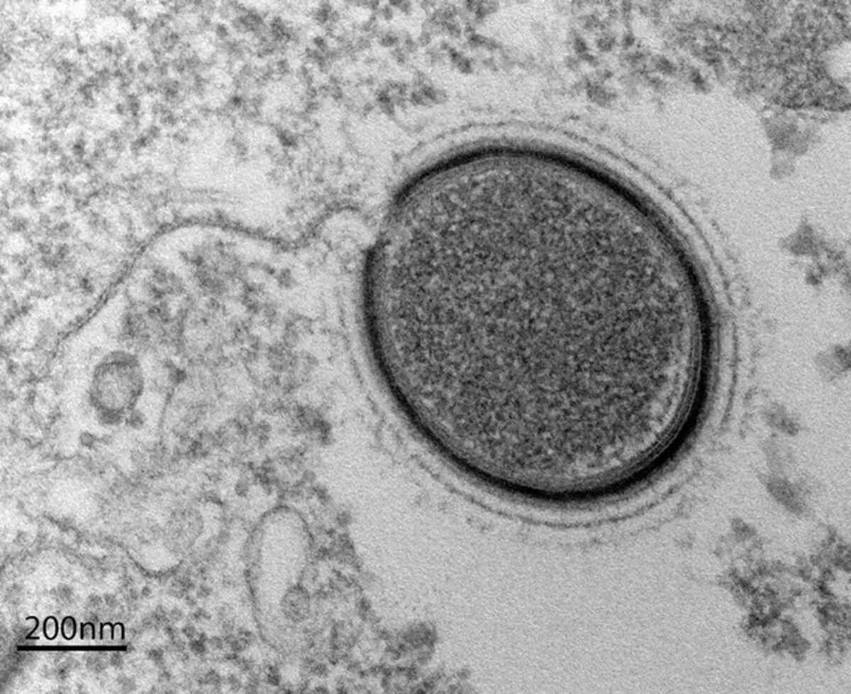 फोटो №1 - शास्त्रज्ञांनी 30 हजार वर्षे वयोगटातील विशाल व्हायरस पुनरुज्जीवित करण्याचा निर्णय घेतला