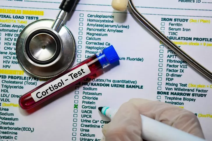 Ảnh số 1 - Mức Cortisol được gắn với nguy cơ tử vong do Covid-19