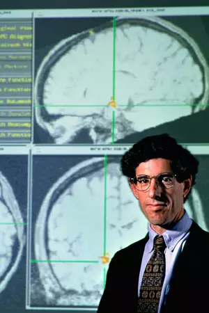 Foto №2 - O cerebro ao traballo impide a inmunidade