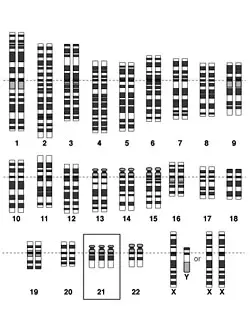 Foto №4 - Dokter Down's Malupous Chromosome