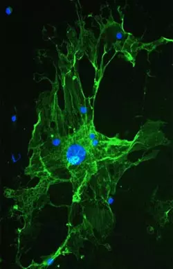 Nombor Foto 5 - Cirrhosis dalam sel tikus