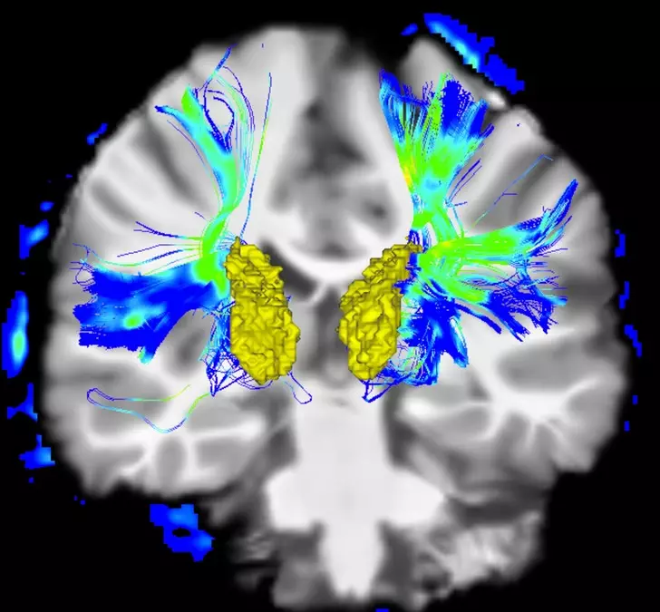 Foto №1 - Parkinson's sykte leard om te diagnostisearjen troch geur