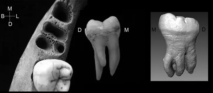 عکس №1 - دندان ها با سه ریشه به ساکنان آسیا از Denice رفتند