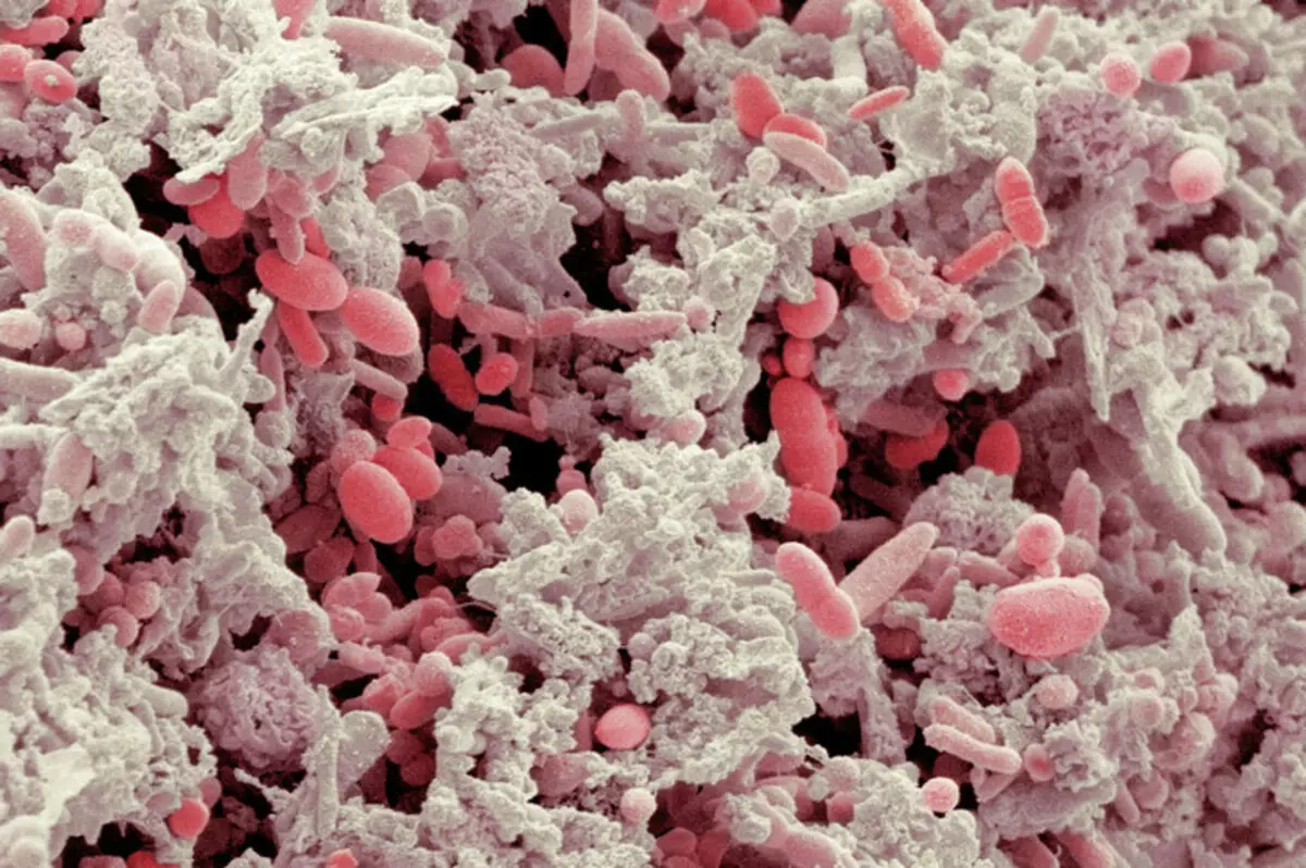 Fotografija №2 - Upravljačko poduzeće: Kako bakterije vode ljude