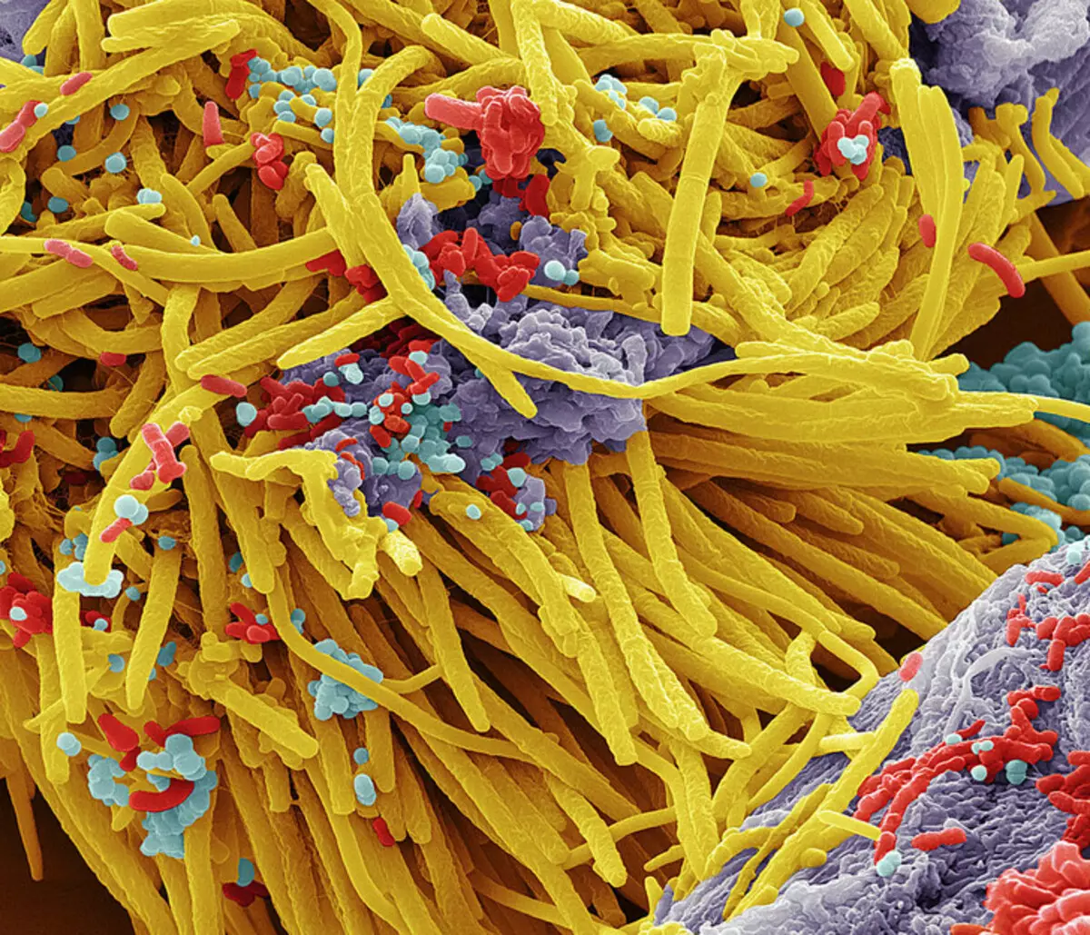 Foto nummer 5 - Håndteringsvirksomhed: Hvordan bakterier fører folk