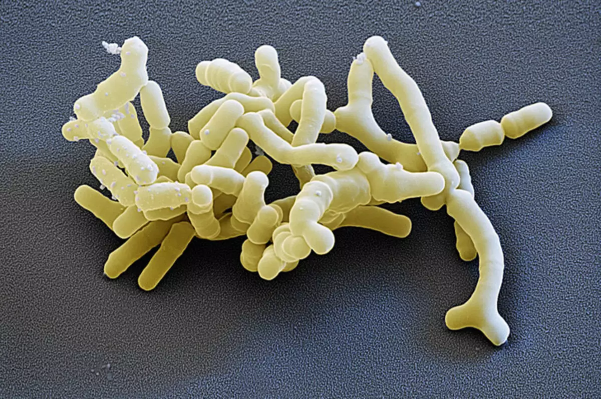 Լուսանկարը 6 - Կառավարման ընկերություն. Որպես մանրէներ են առաջացնում մարդկանց