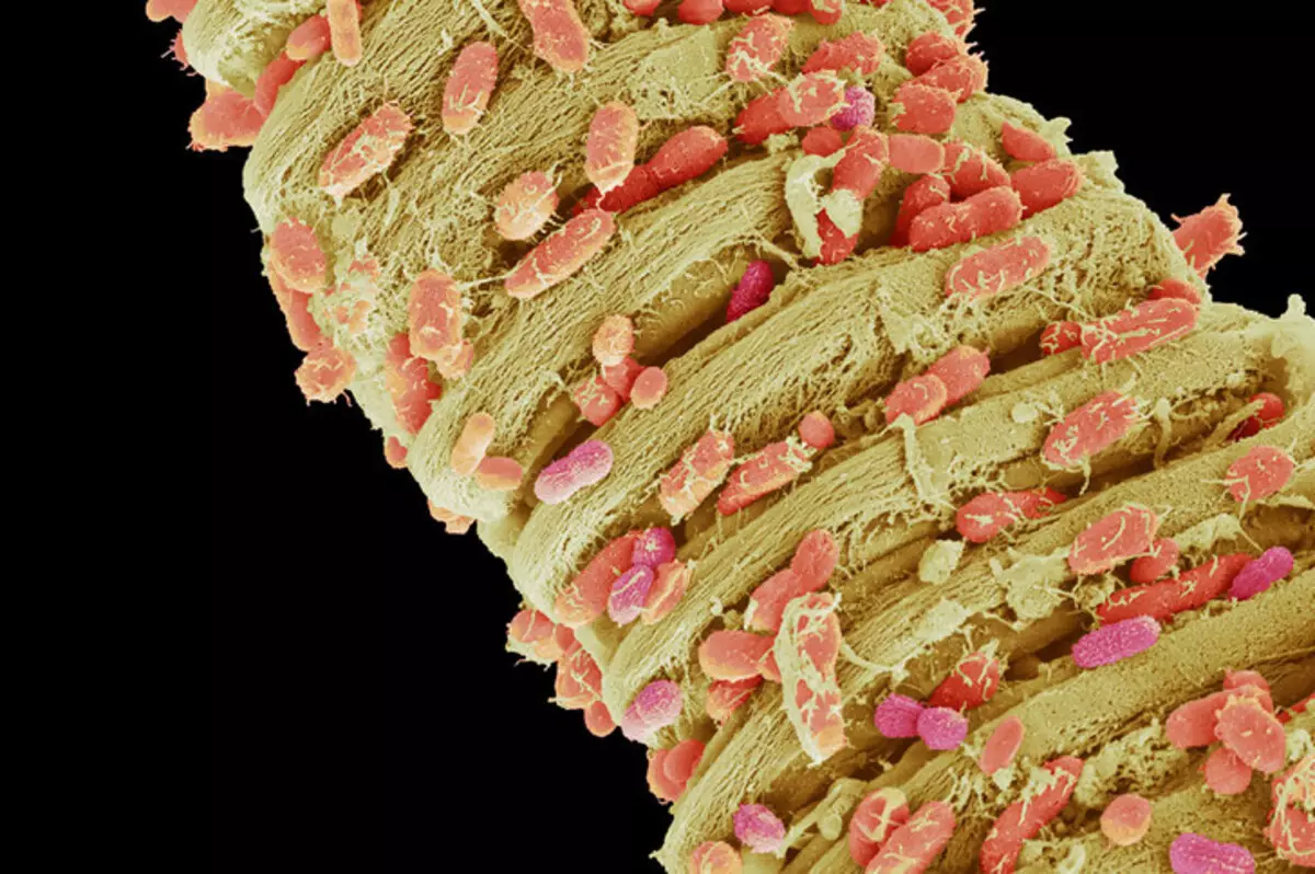 Фото број 7 - Друштво за управување: Како бактериите ги водат луѓето