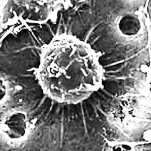 Фотографија №1 - Матичне ћелије спаљене кости