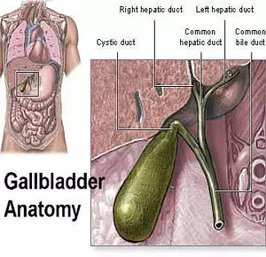 Mynd №1 - Gallbladder fjarlægður í gegnum munninn