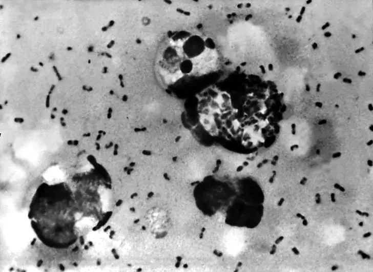 Foto №1 - El genoma més antic de la plaga bubònic es va trobar a Rússia