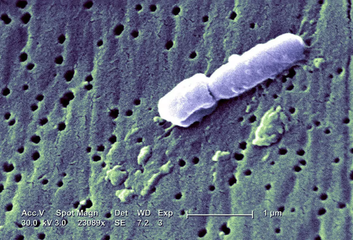 Mufananidzo №1 - zvisingazivikanwe Superbacteries inowanikwa muTexas