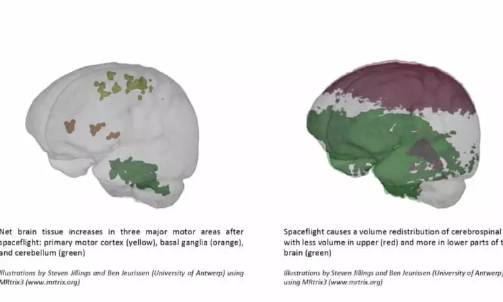 №1 լուսանկար. Գիտնականները պատմեցին, թե ինչպես է ուղեղը փոխվում տարածության մեջ