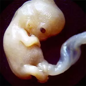 Mufananidzo wemifananidzo 1 - genetic kutsvagisa kweiyo fetus inowedzera huwandu hwekubvisa nhumbu